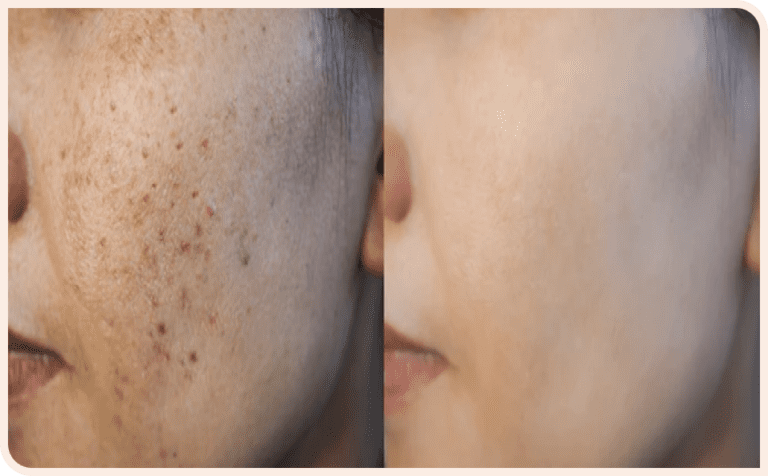 Skin Treatment for Medical Conditions at Skinsure