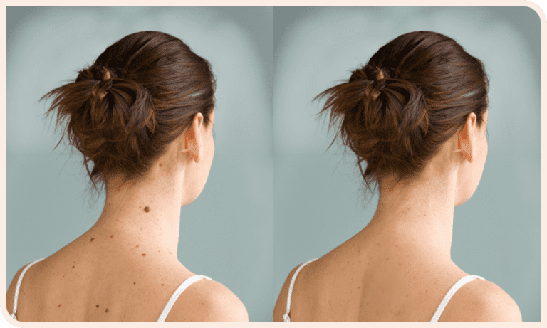 Advanced Skin Growth Treatment Solutions | Skinsure